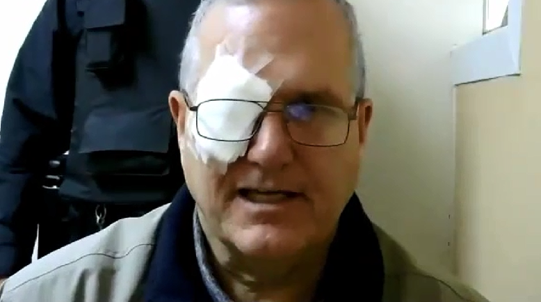 Video: Reformalizan a John Cobin por disparos en Reñaca imputado de dos ...