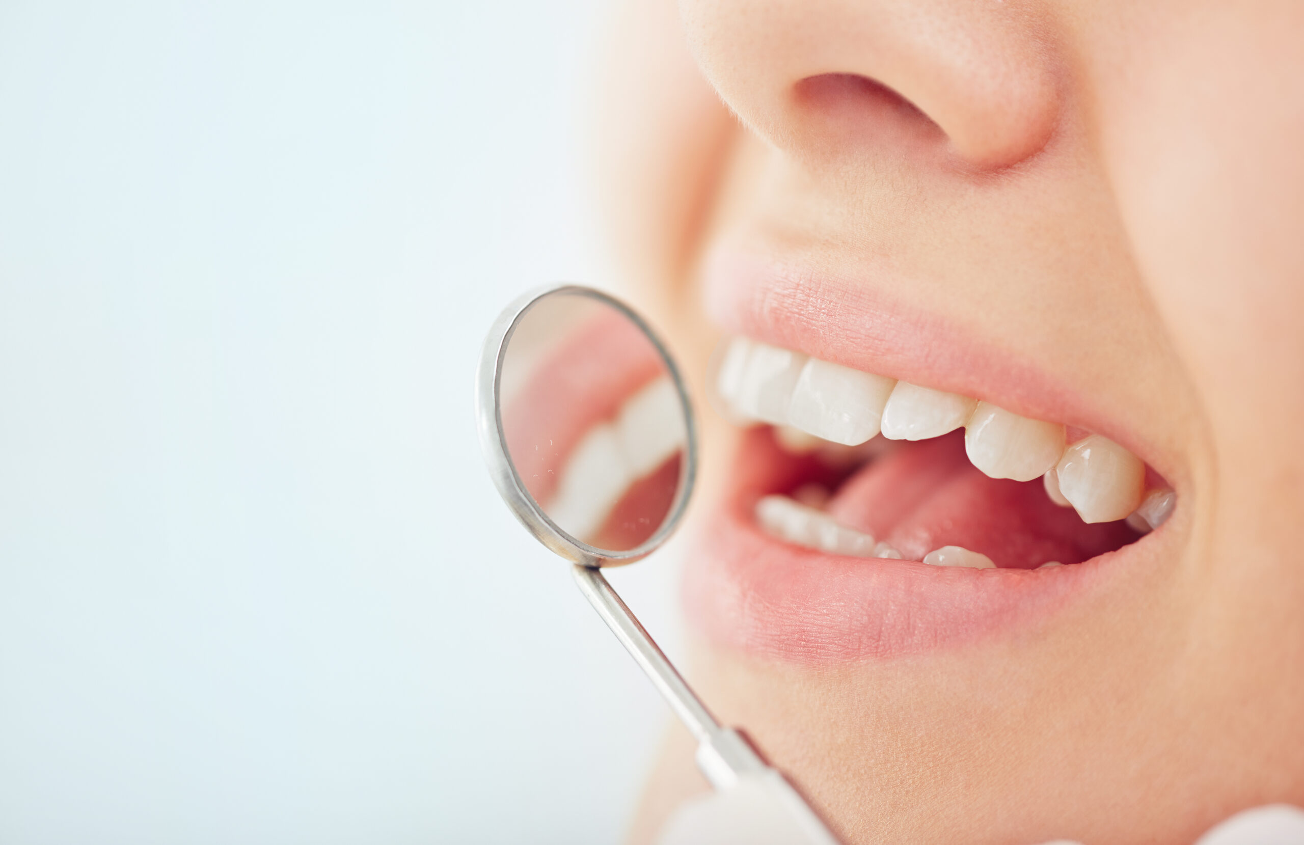 Dientes saludables: Conoce qué alimentos pueden ayudar a prevenir las ...